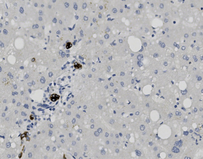 Tissue-Tek Genie | Rapid true random access IHC staining
