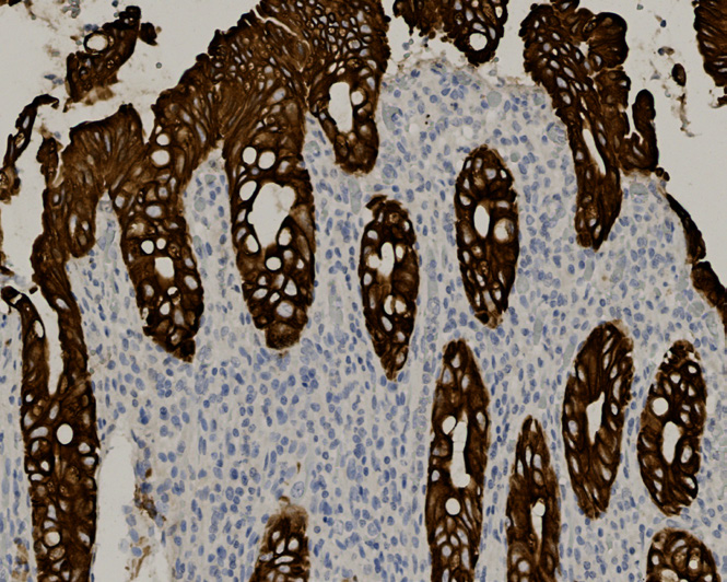 Tissue-Tek Genie | Rapid true random access IHC staining