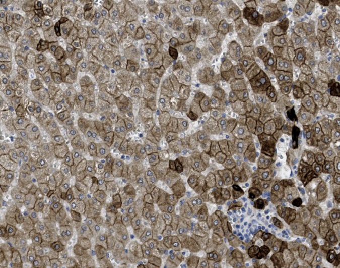 Tissue-Tek Genie | Rapid true random access IHC staining